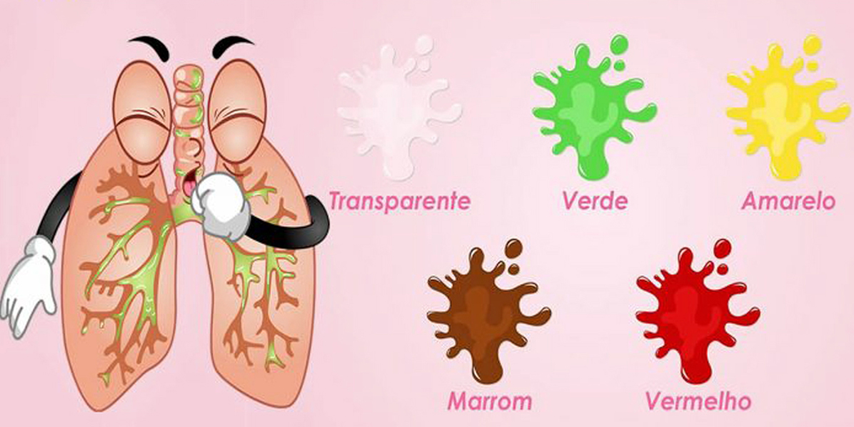 A cor do catarro pode revelar como anda a sua saúde